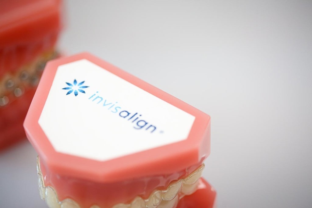 Treating Crossbites Using Invisalign | Topeka, KS | WH