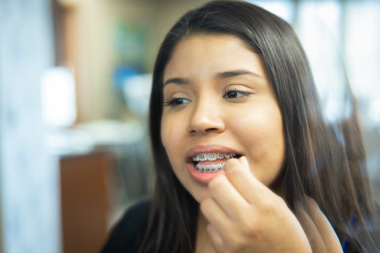 Rubber Bands for Braces: How to Use Them Correctly | WH Orthodontics